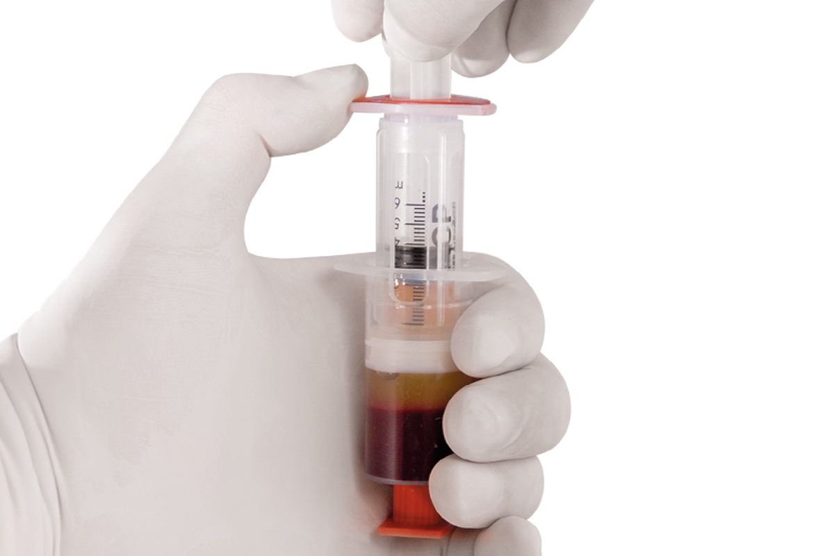 PRP Injection de Plasma Riche en Plaquettes by Arthrex ACP®