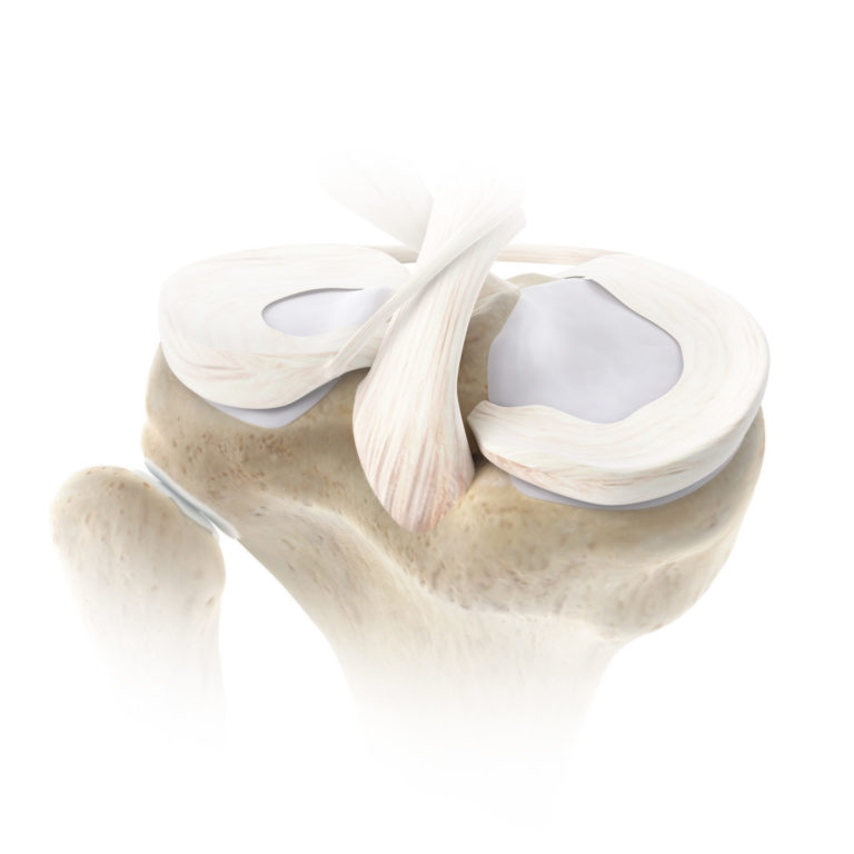 Lésions méniscales - ACP Thérapie | Arthrex