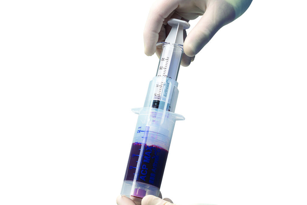 ACP Max™ - ACP Thérapie | Arthrex