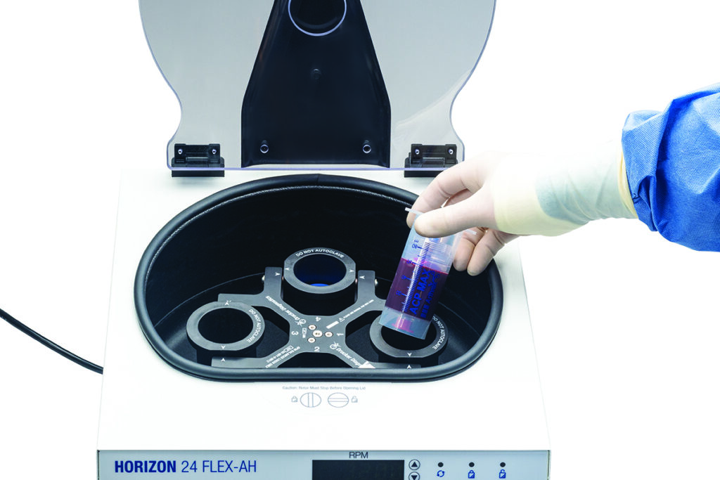 ACP Max™ - ACP Thérapie | Arthrex