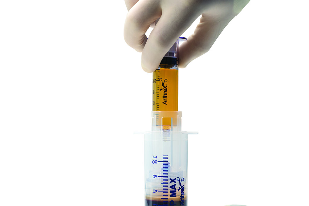 ACP Max™ - ACP Thérapie | Arthrex